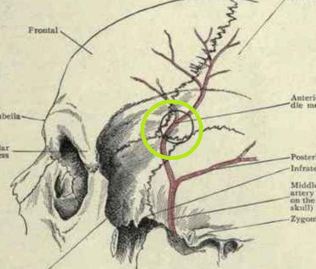 Level 3 - Neurology, ENT, & Ophthalmology (Images) - Oxford Medicine ...