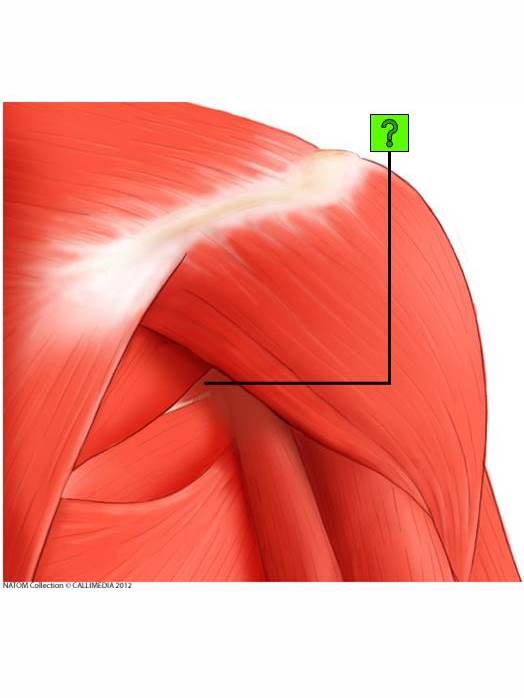 Level 28 - Hombro - v. posterior - músculos superficiales - Anatomía ...