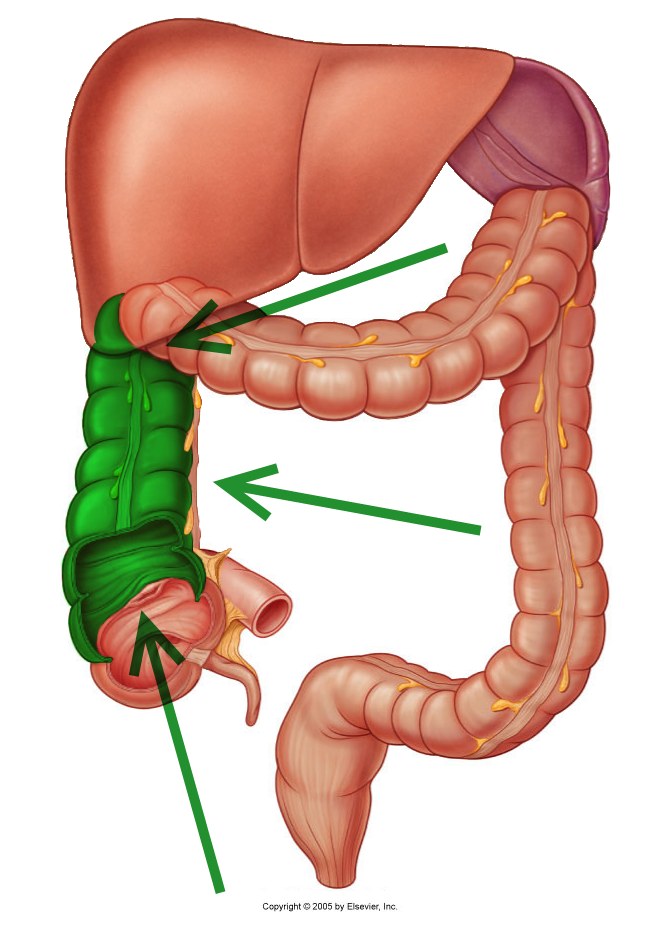 Colon Ascending