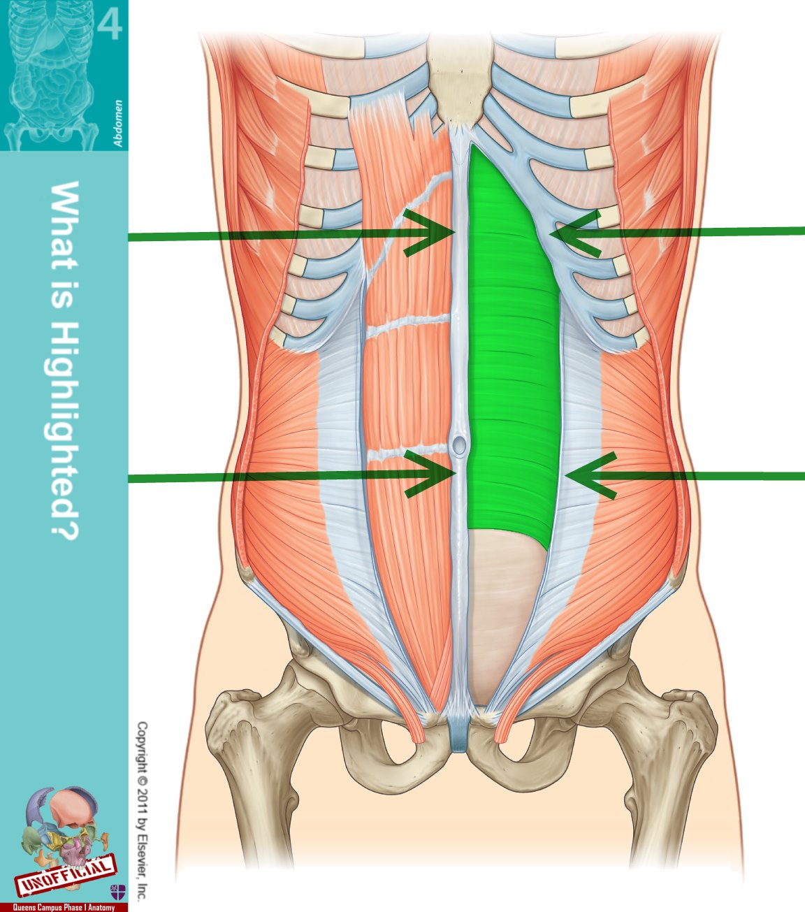 Rectus Sheath I Anatomy Lecturio Youtube - vrogue.co