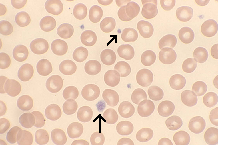 Level 1 - Haematology - Memrise