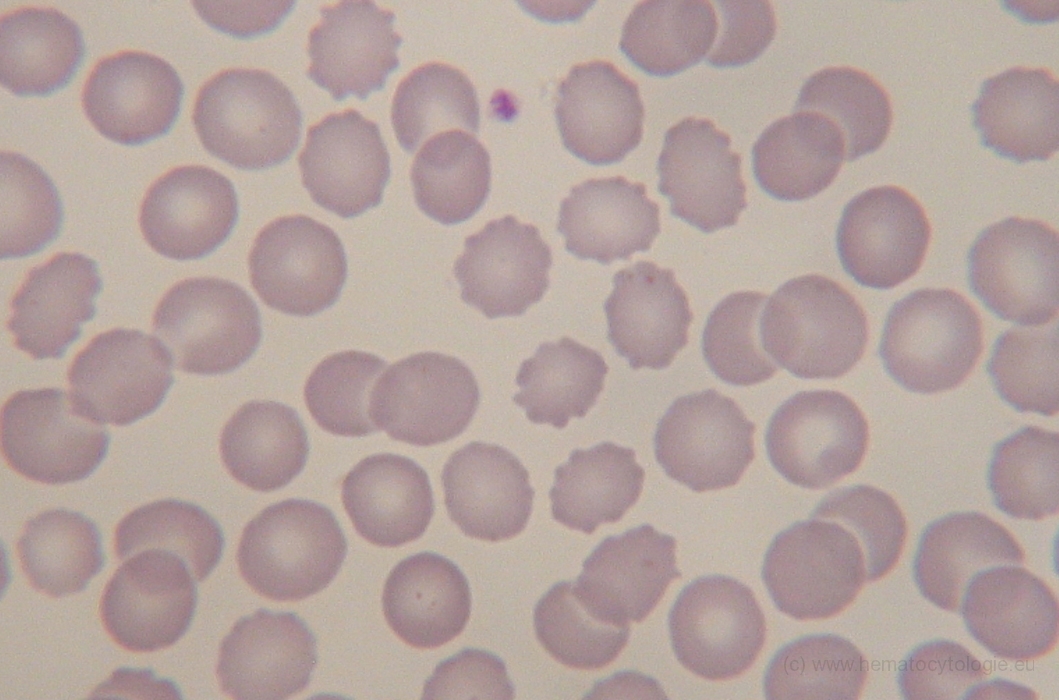 Level 4 - Rode bloedbeeld (plaatje) - Haematology - Memrise Level 4 - Rode bloedbeeld (plaatje) - Haematology - Memrise