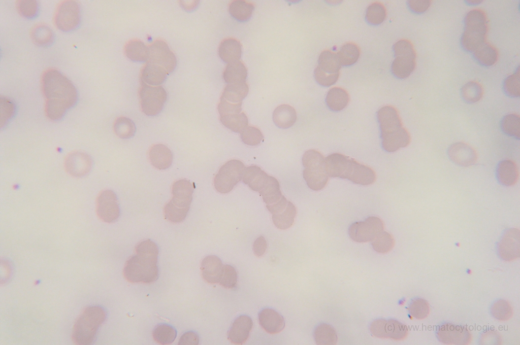 Level 4 - Rode bloedbeeld (plaatje) - Haematology - Memrise Level 4 - Rode bloedbeeld (plaatje) - Haematology - Memrise