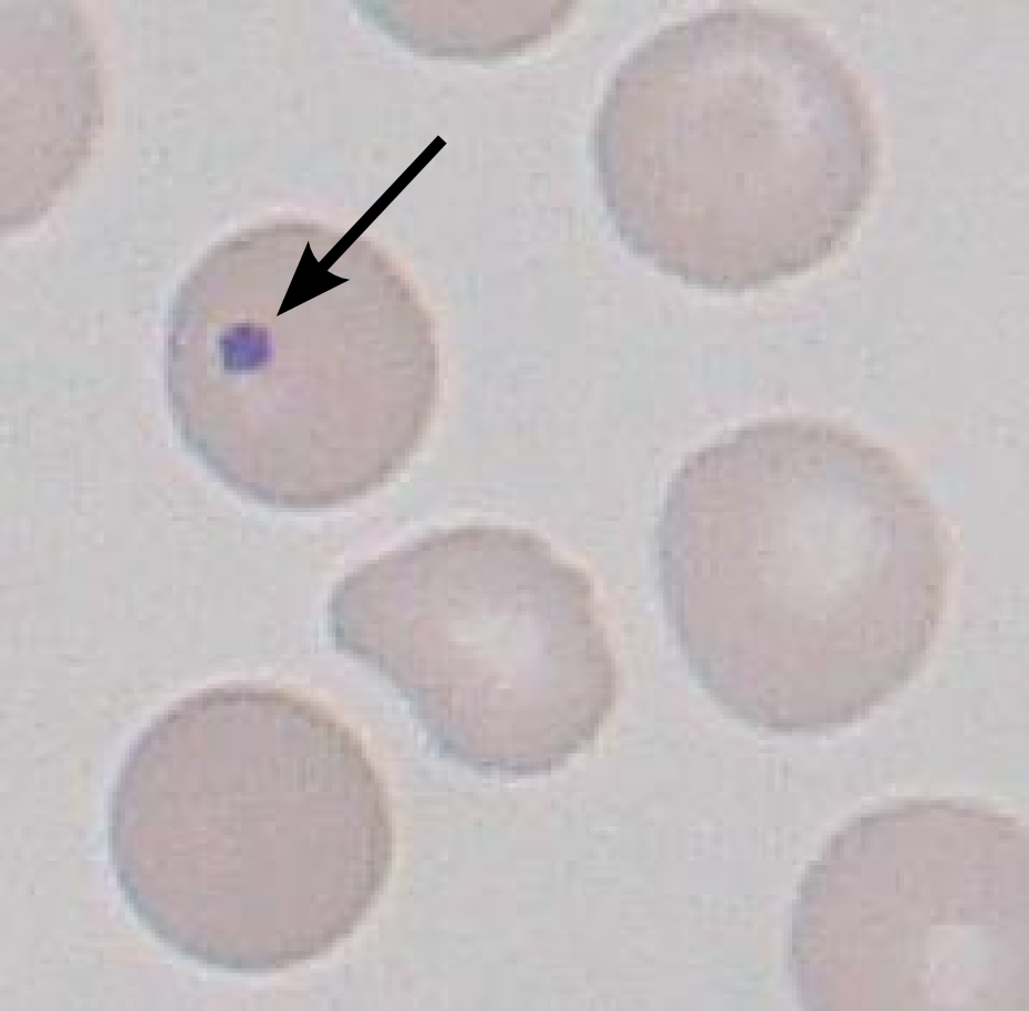 Level 4 - Rode bloedbeeld (plaatje) - Haematology - Memrise Level 4 - Rode bloedbeeld (plaatje) - Haematology - Memrise