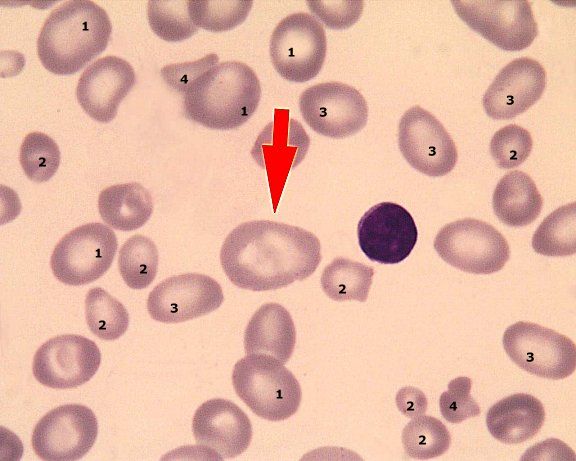 Level 3 - Haematology, - Memrise