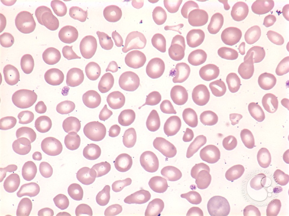 Level 4 - Rode bloedbeeld (plaatje) - Haematology - Memrise Level 4 - Rode bloedbeeld (plaatje) - Haematology - Memrise