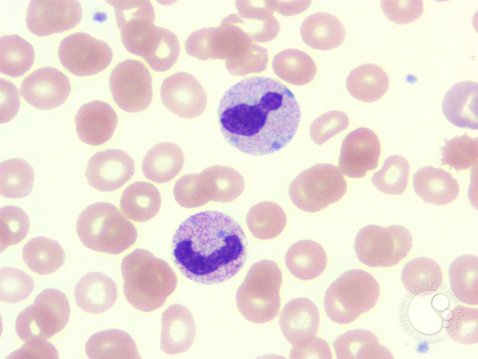 Level 5 - Haematology - Memrise