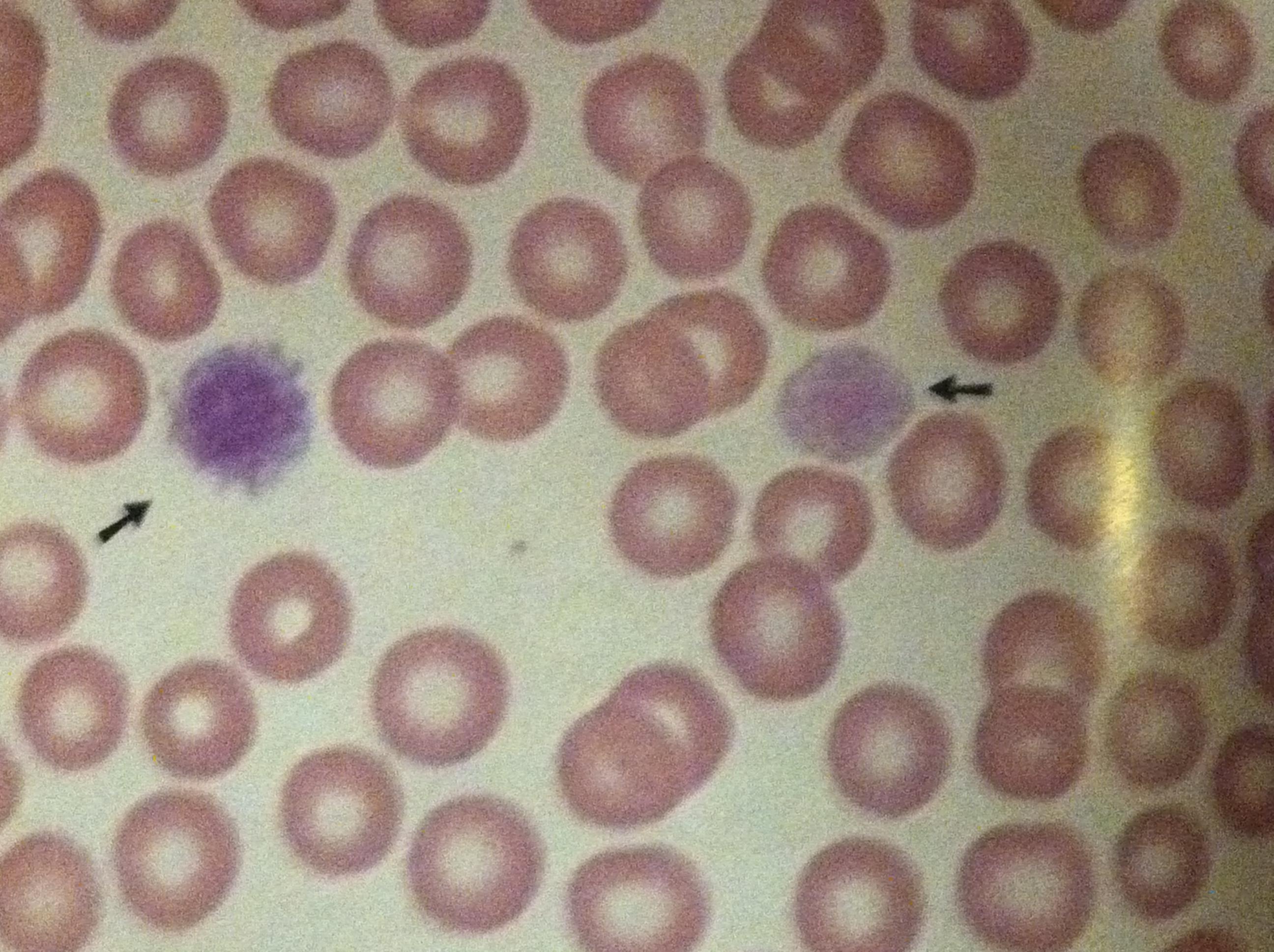 Level 4 - Rode bloedbeeld (plaatje) - Haematology - Memrise Level 4 - Rode bloedbeeld (plaatje) - Haematology - Memrise