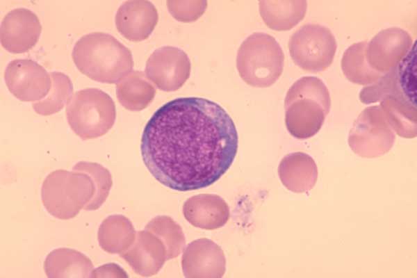 Level 1 - Haematology - Memrise