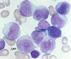 Level 2 - Haematology - Memrise