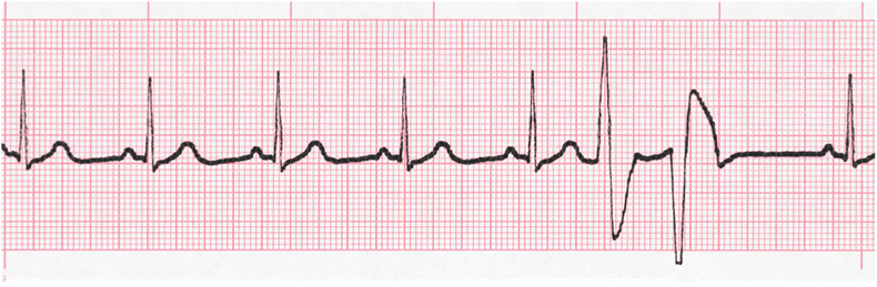 Level 3 - ECG - Memrise