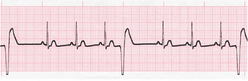 Level 3 - 21 - 30 - ECG - Memrise