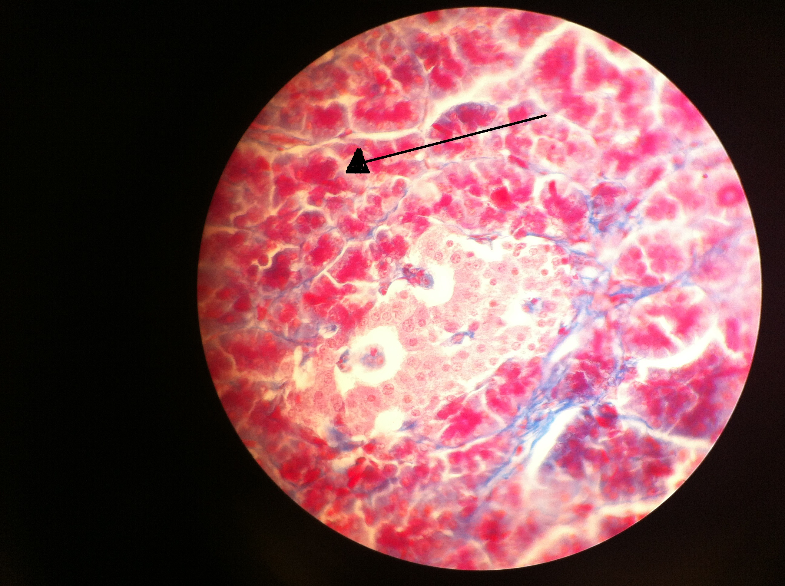 Level 15 - Endocrine Histology - Anatomy and Physiology I - Memrise